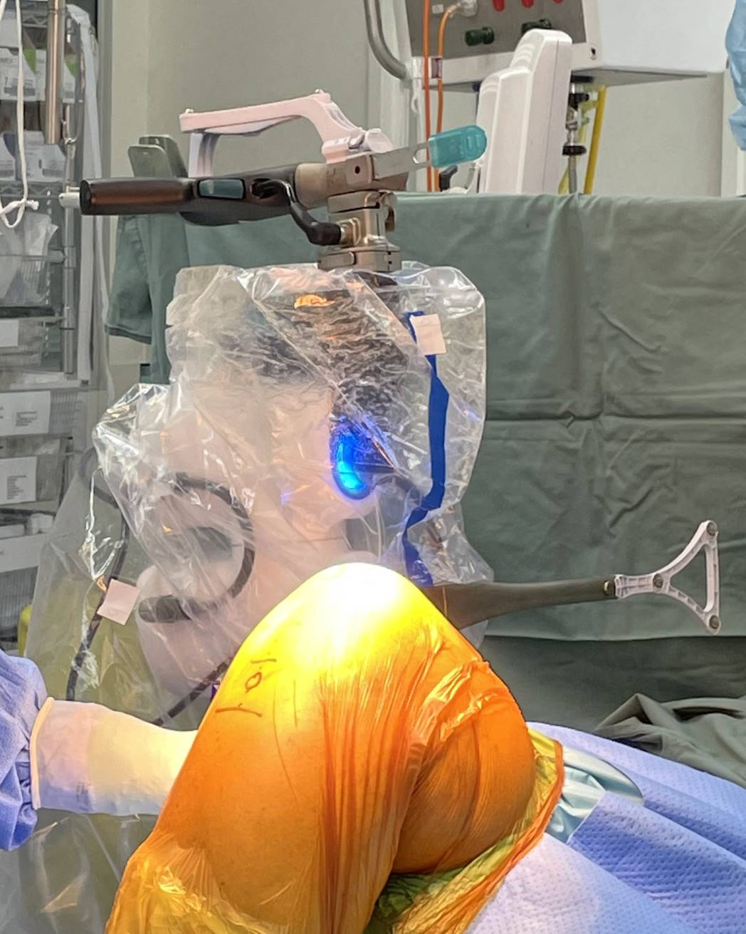 Advances in Knee Replacements | Dr Graeme Brown